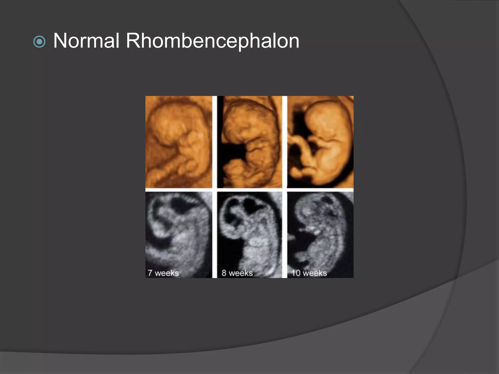 Normal early pregnancy imaging | PPT