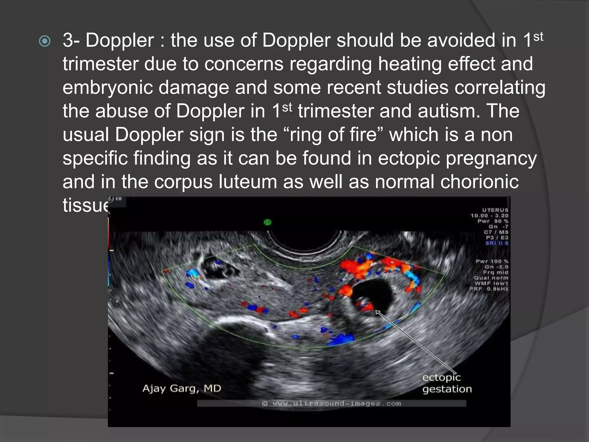 Normal early pregnancy imaging | PPT