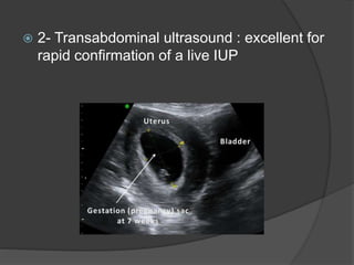 Normal early pregnancy imaging | PPT