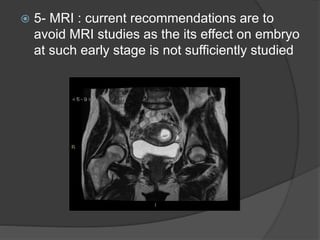 Normal early pregnancy imaging | PPTX