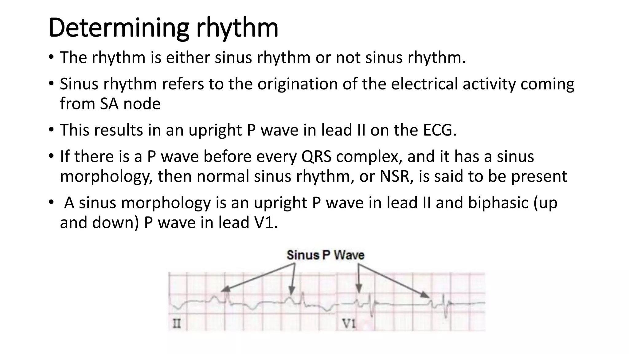 NORMAL ECG.pptx