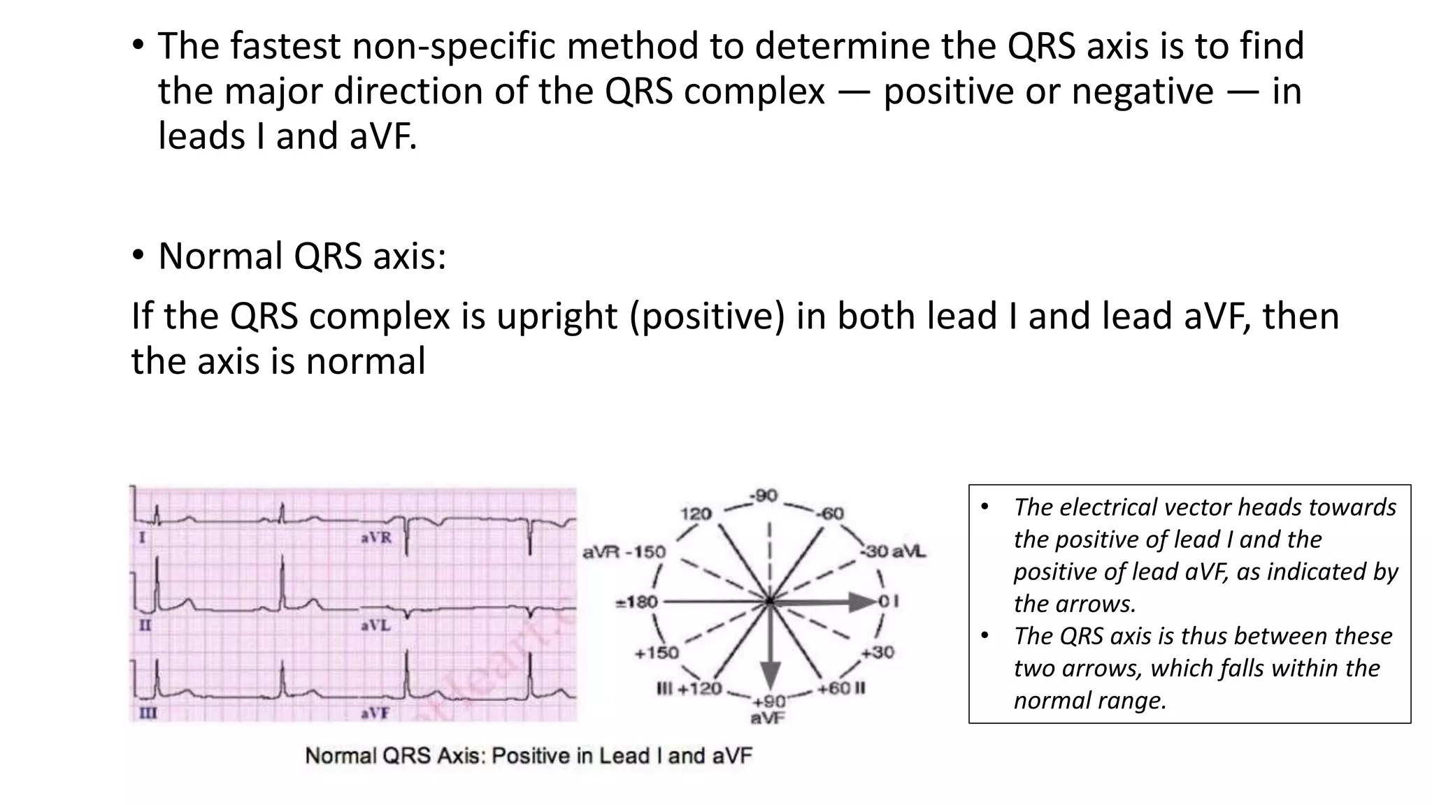 NORMAL ECG.pptx | Heart and Cardiovascular Diseases | Diseases and ...