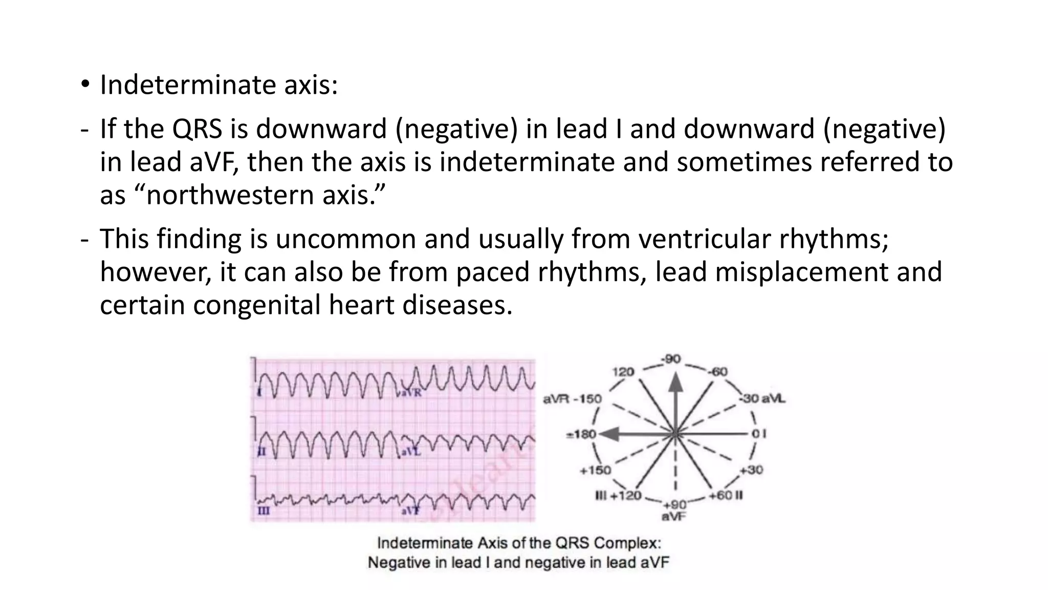 NORMAL ECG.pptx