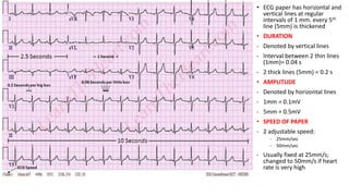 NORMAL ECG.pptx