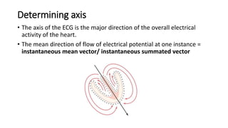 NORMAL ECG.pptx