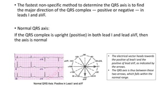 NORMAL ECG.pptx