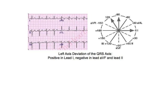 NORMAL ECG.pptx