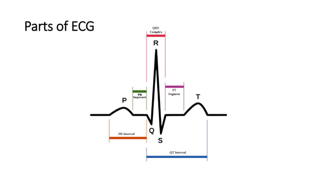 NORMAL ECG.pptx