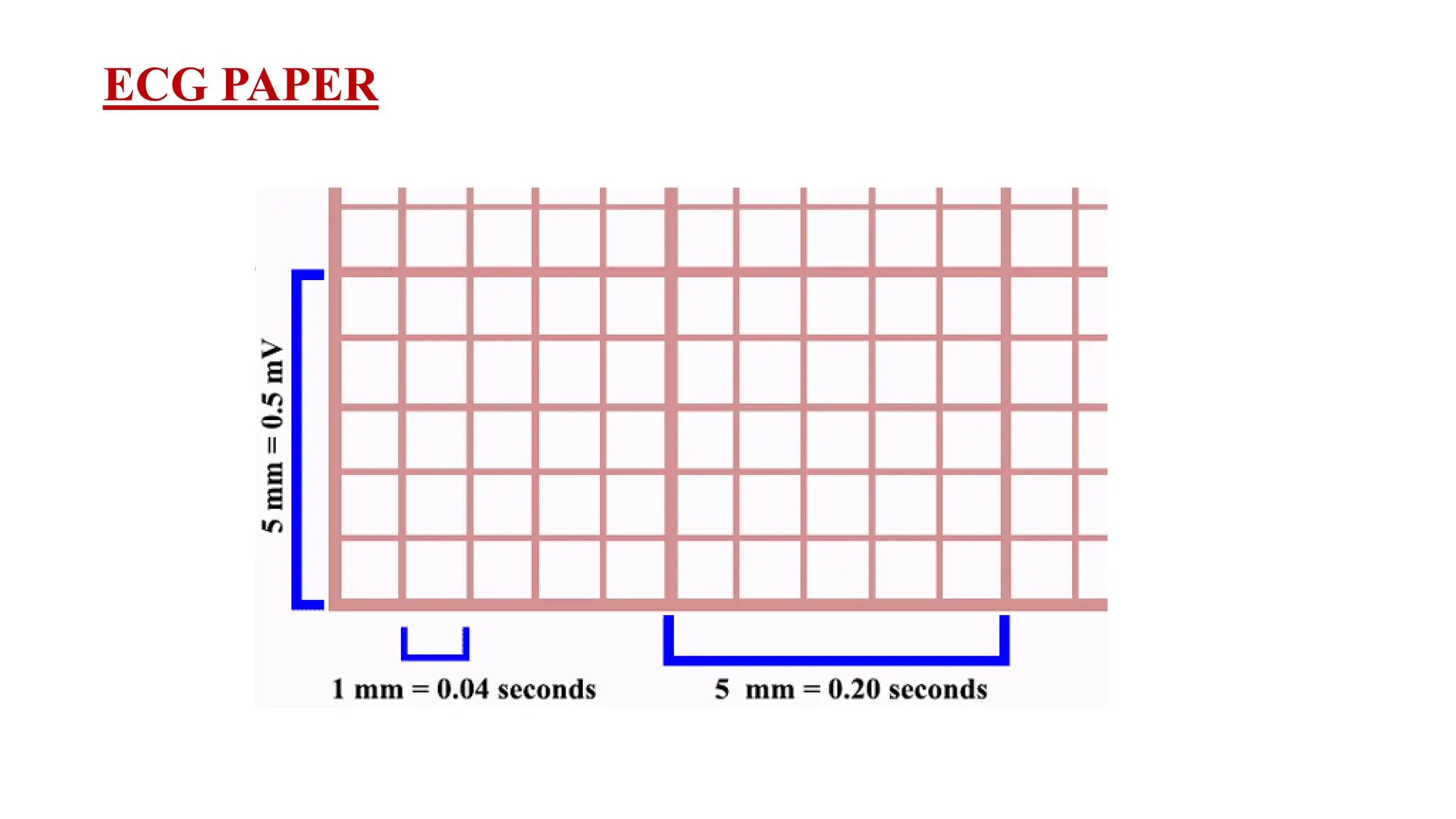 NORMAL Electrocardiogram, ECK/EKG PPT.... | PPTX