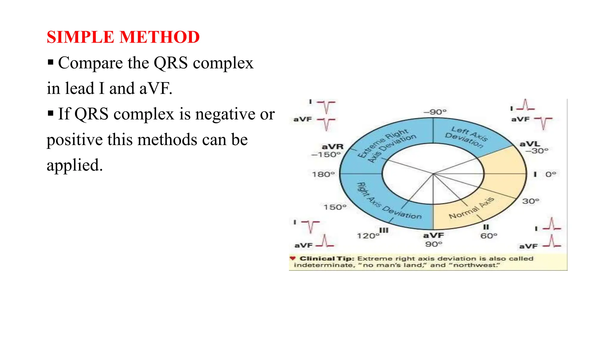 NORMAL Electrocardiogram, ECK/EKG PPT.... | PPTX