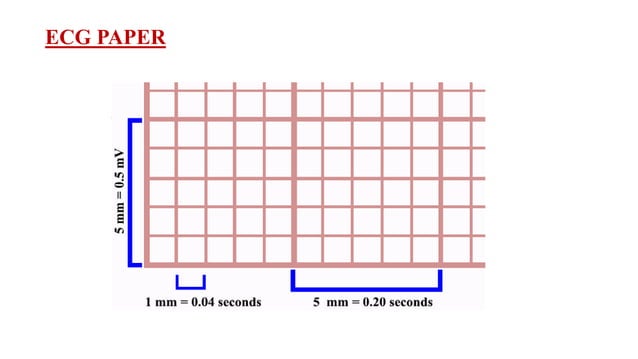 NORMAL Electrocardiogram, ECK/EKG PPT.... | PPTX