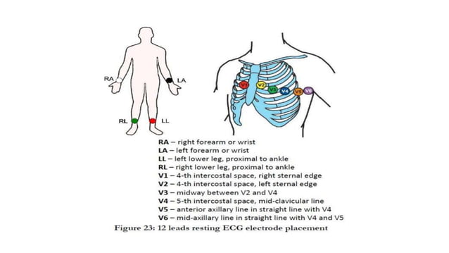 NORMAL Electrocardiogram, ECK/EKG PPT.... | PPTX