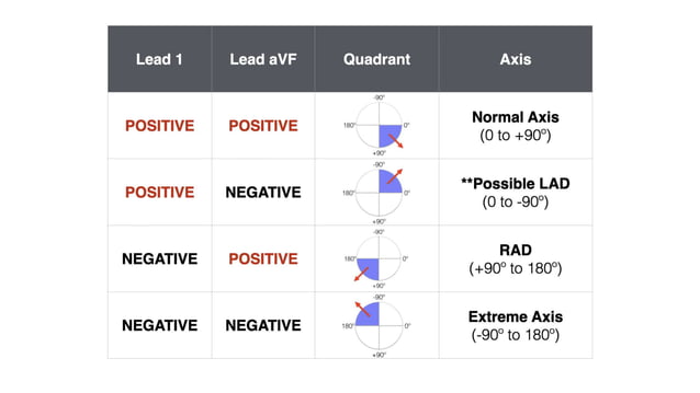 NORMAL Electrocardiogram, ECK/EKG PPT.... | PPTX