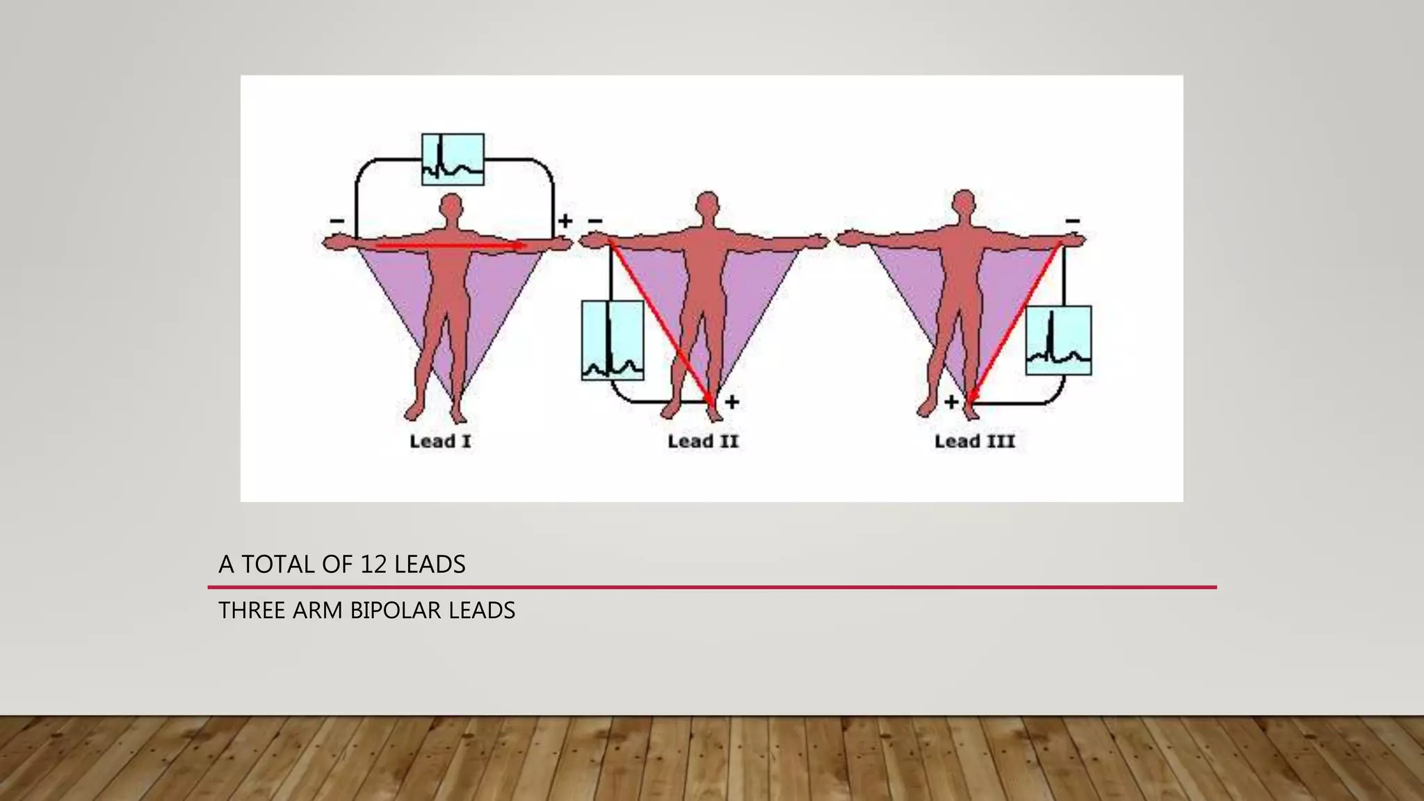 12 LEAD NORMAL ELECTROCARDIOGRAM | PPTX