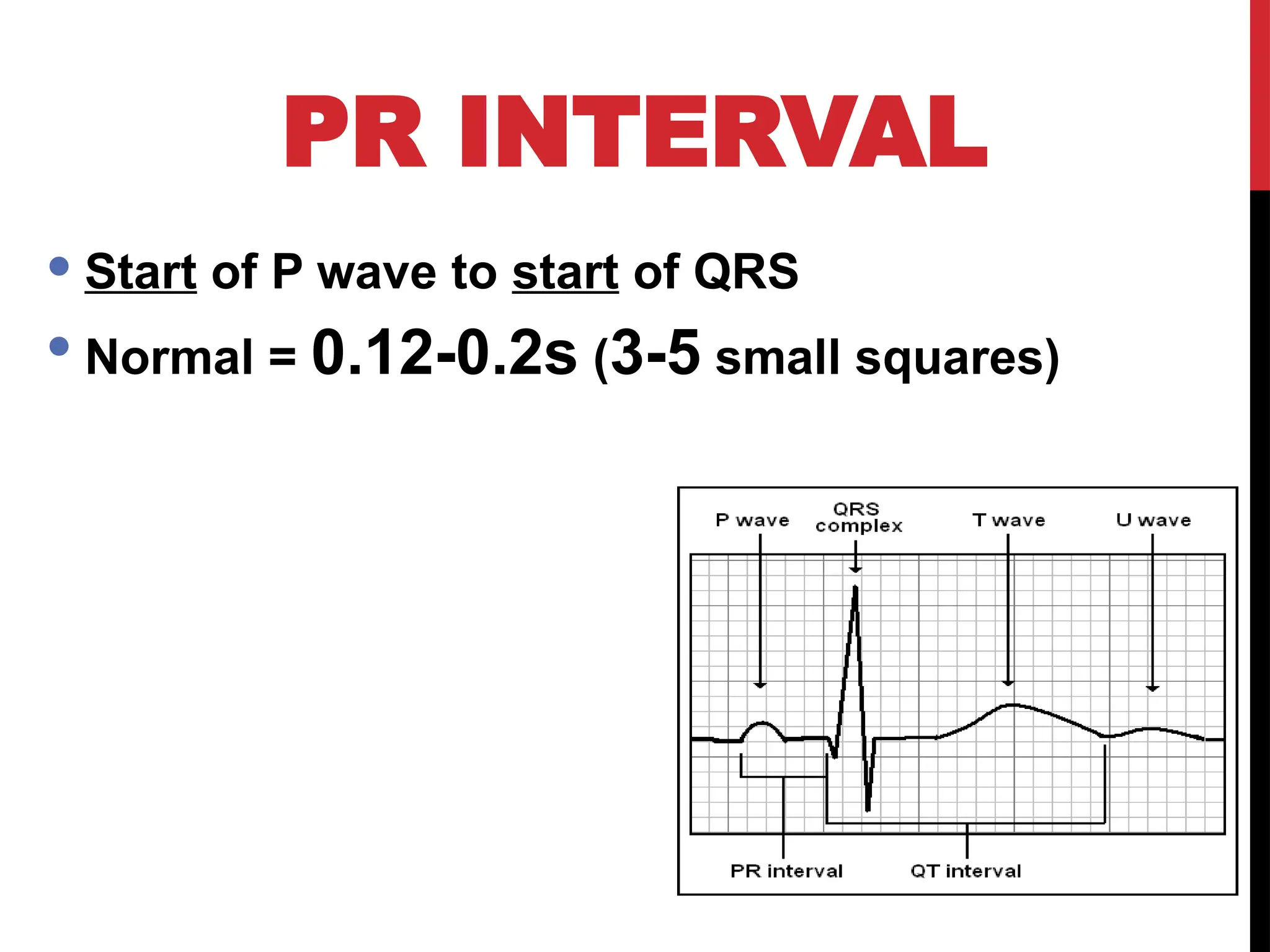 normal ECG interpretation presentation.ppt | Heart and Cardiovascular ...