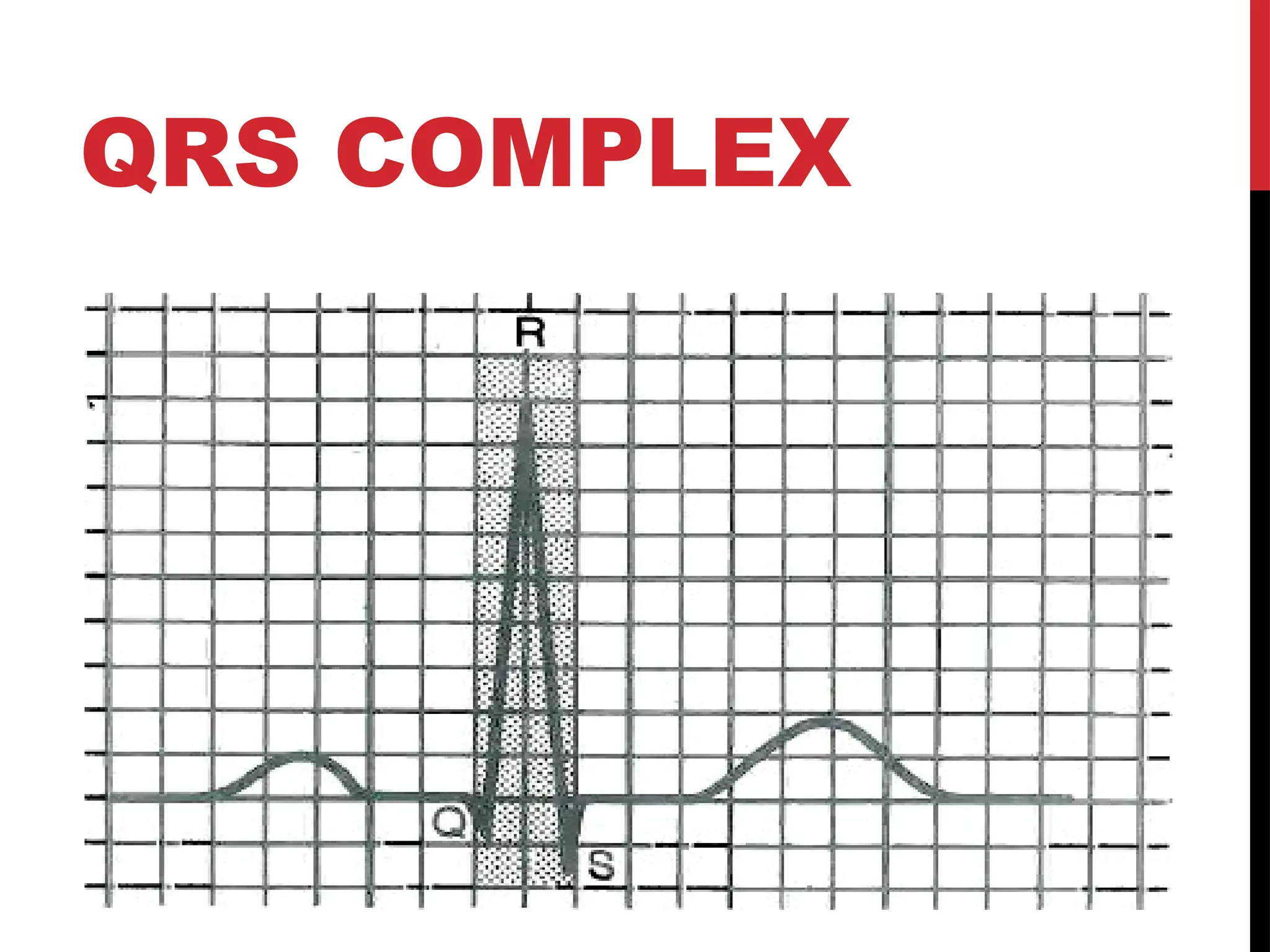 normal ECG interpretation presentation.ppt | Heart and Cardiovascular ...