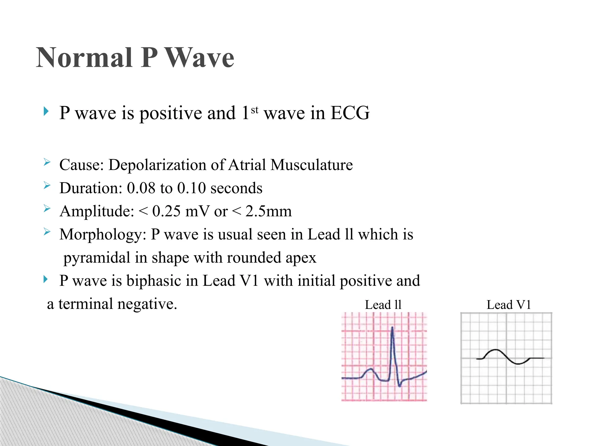 New 1 Normal ECG and it’s Interpretation.pptx