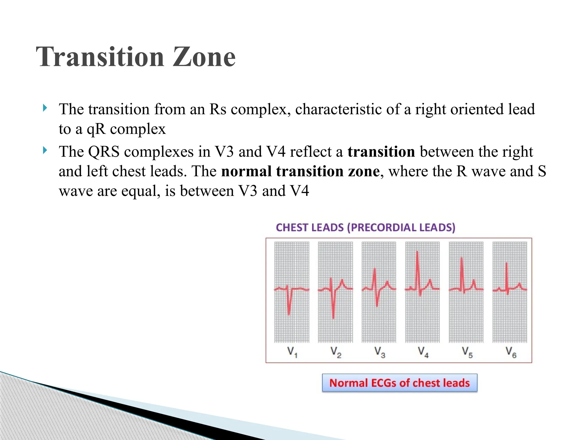 New 1 Normal ECG and it’s Interpretation.pptx