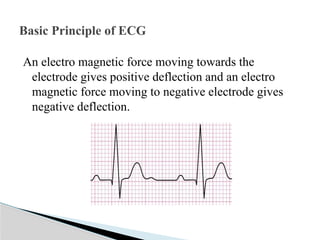 New 1 Normal ECG and it’s Interpretation.pptx