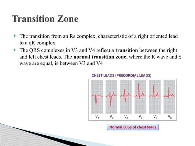 New 1 Normal ECG and it’s Interpretation.pptx