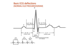 normal ecg dr rashmi.pptx