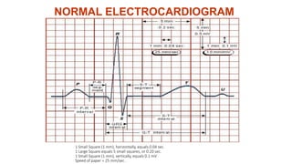 normal ecg dr rashmi.pptx