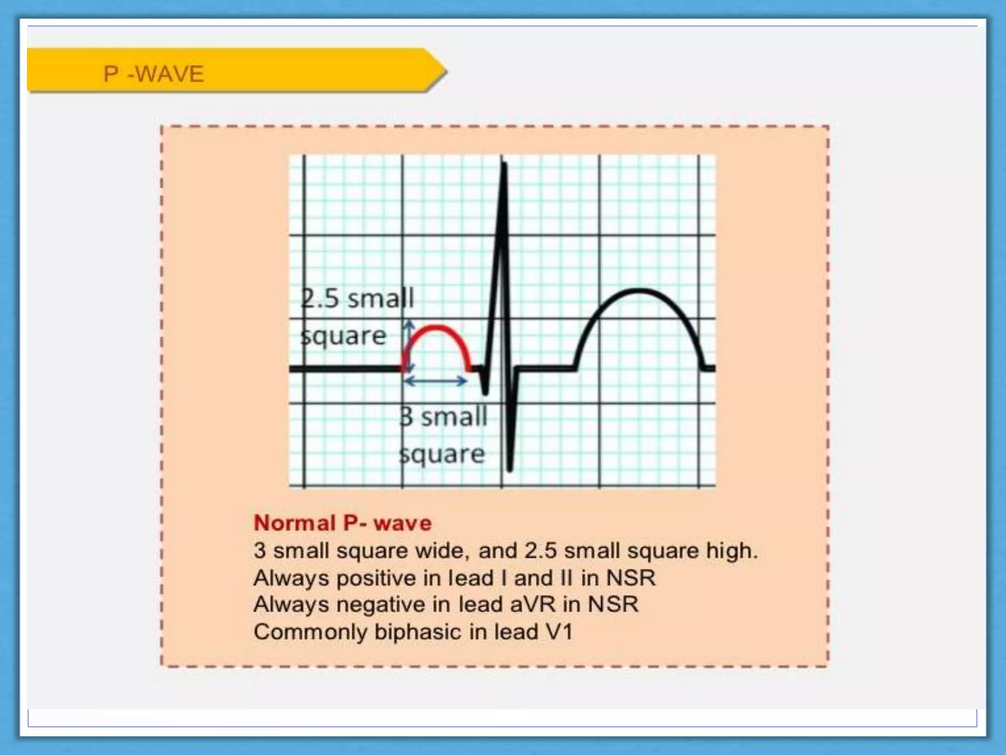 Normal ecg interpretation | PPTX | Heart and Cardiovascular Diseases ...