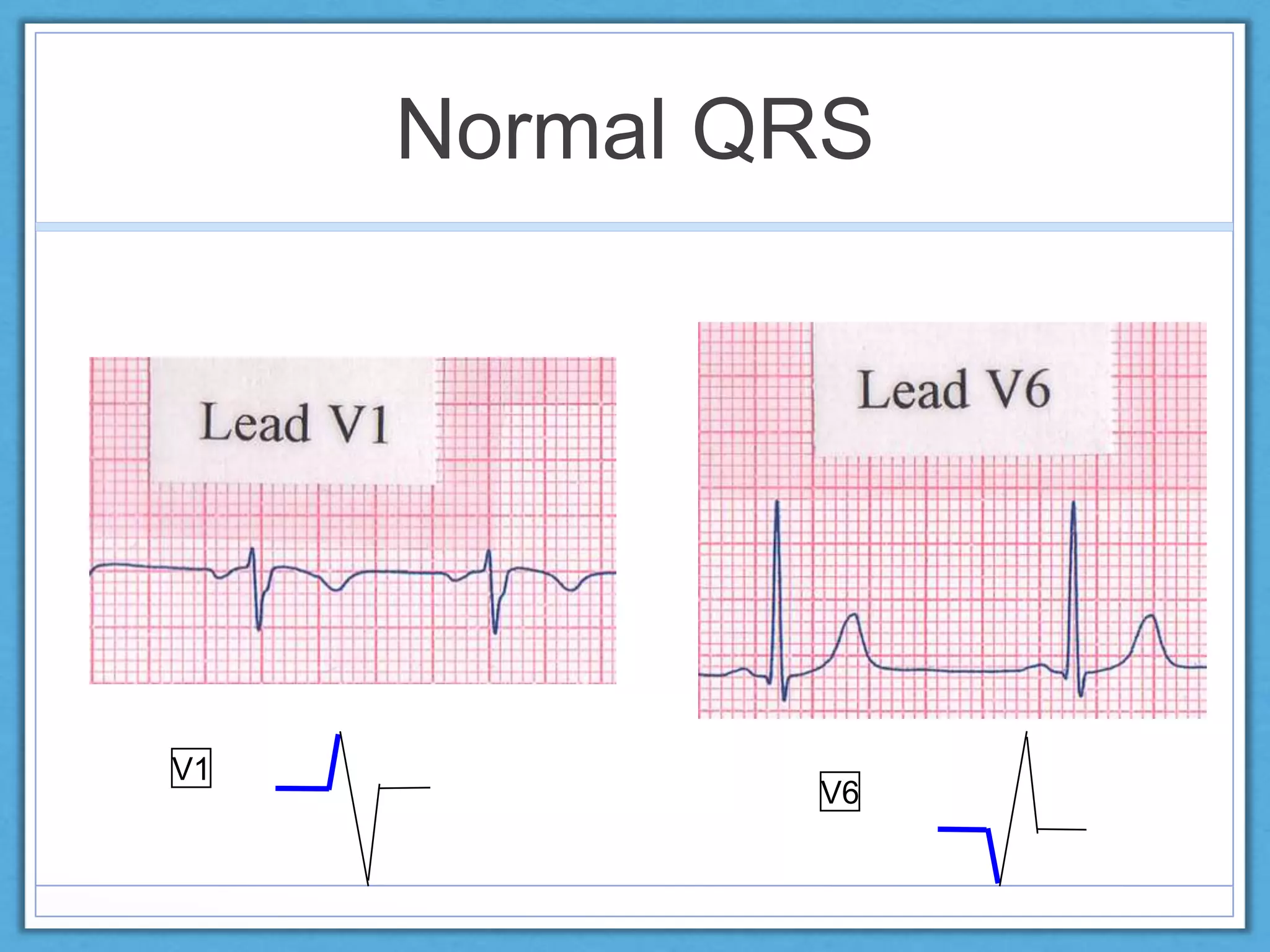 Normal ecg interpretation | PPTX