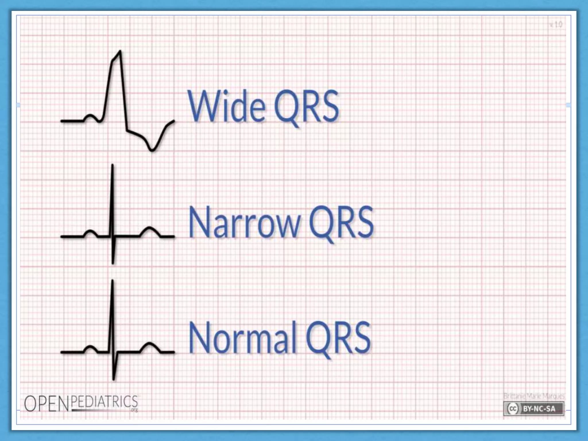Normal ecg interpretation | PPTX