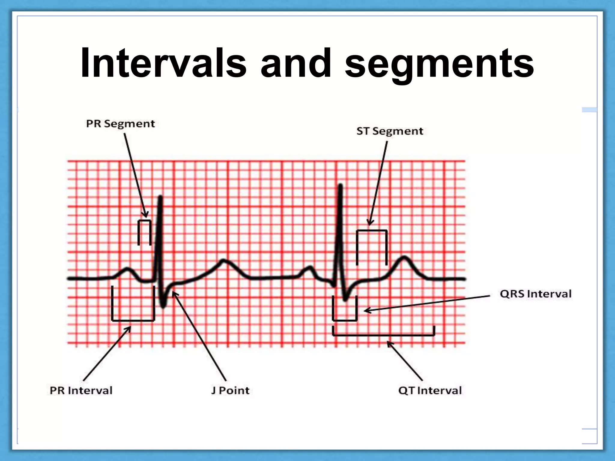 Normal ecg interpretation | PPTX