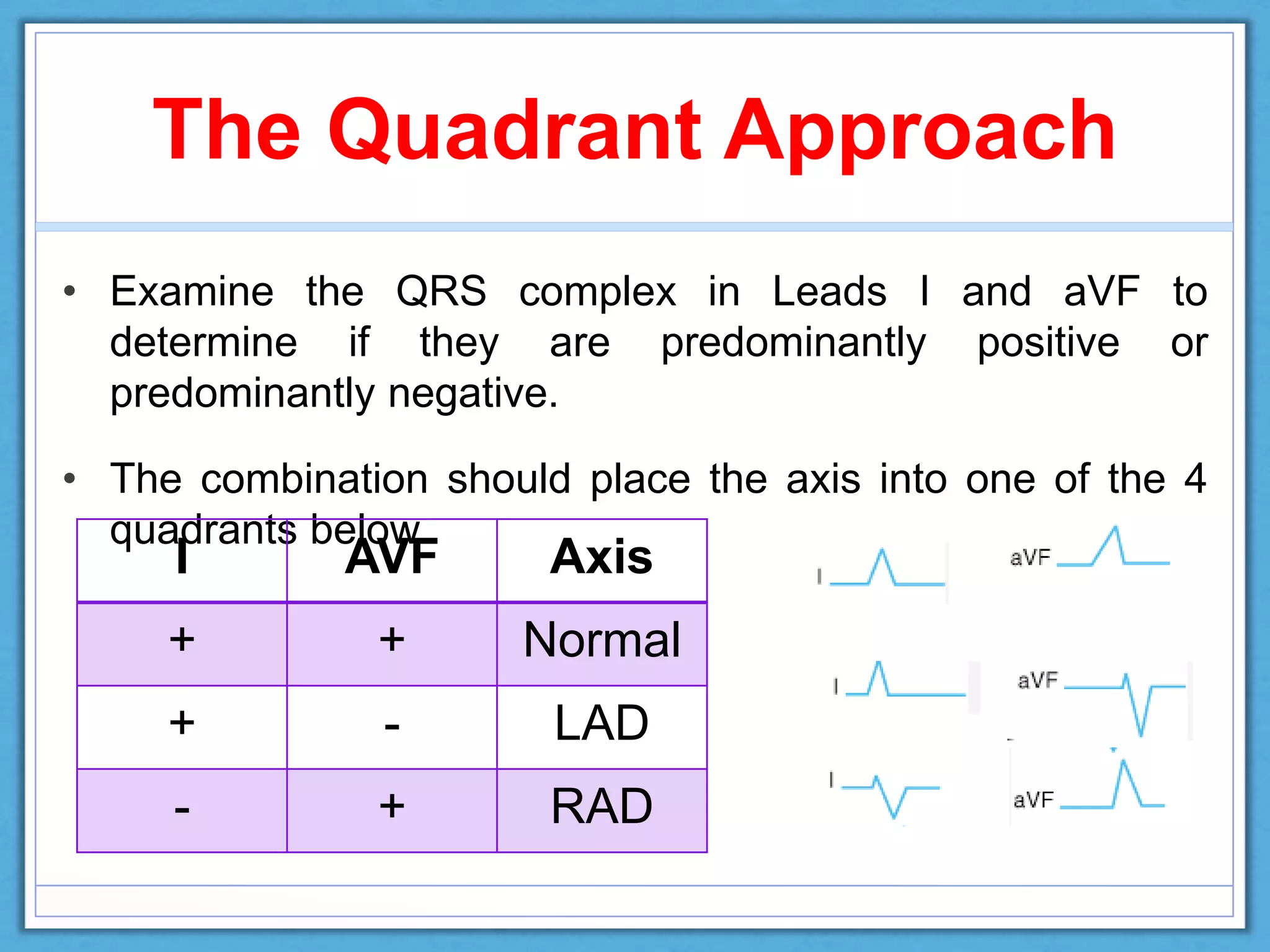 Normal ecg interpretation | PPTX