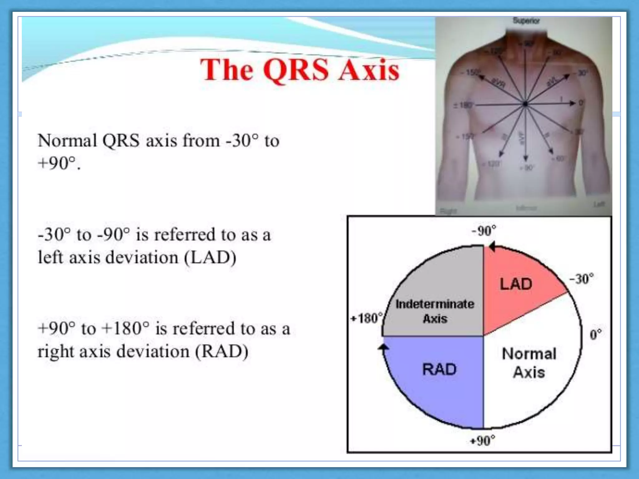 Normal ecg interpretation | PPTX