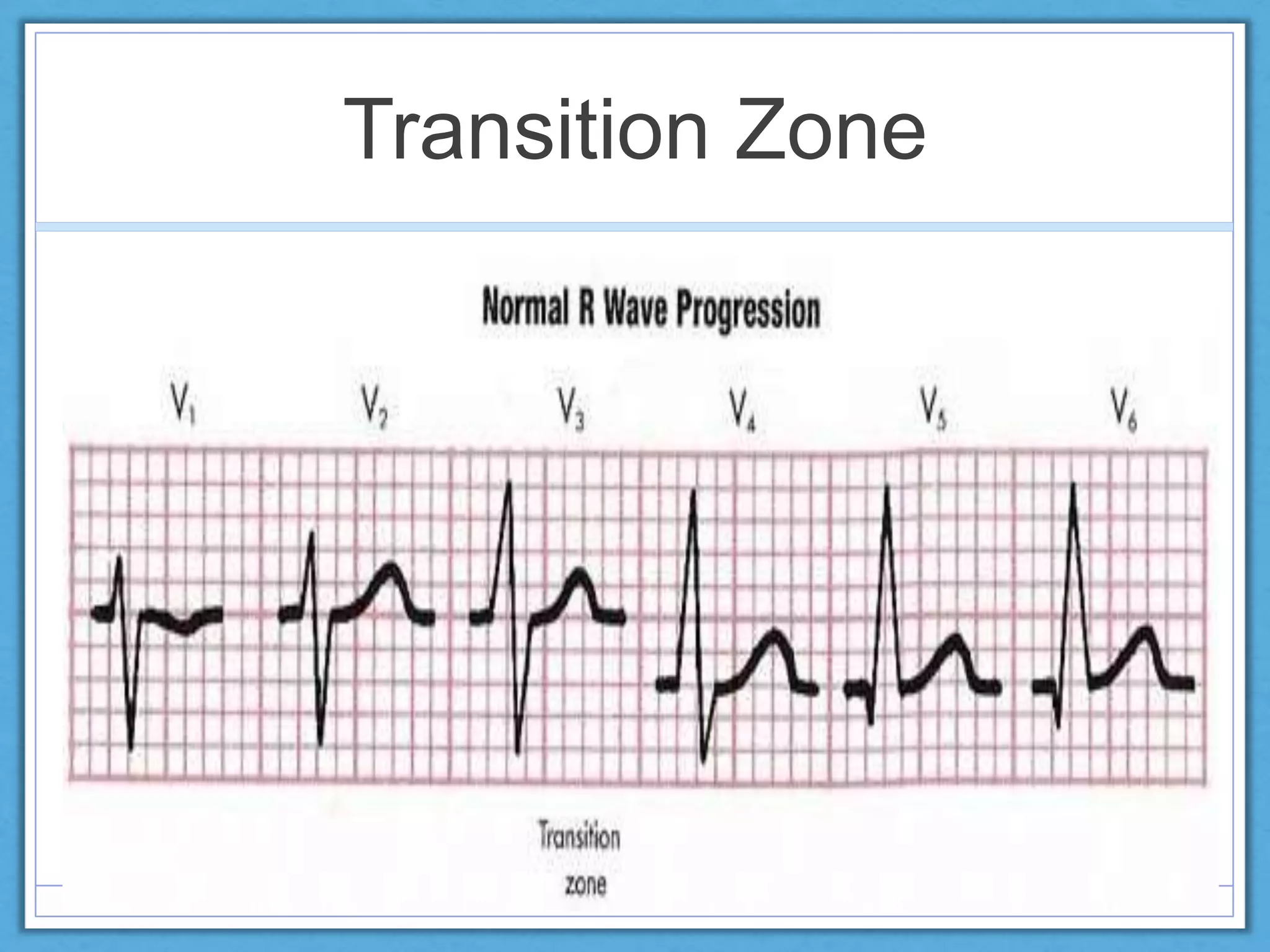 Normal ecg interpretation | PPTX