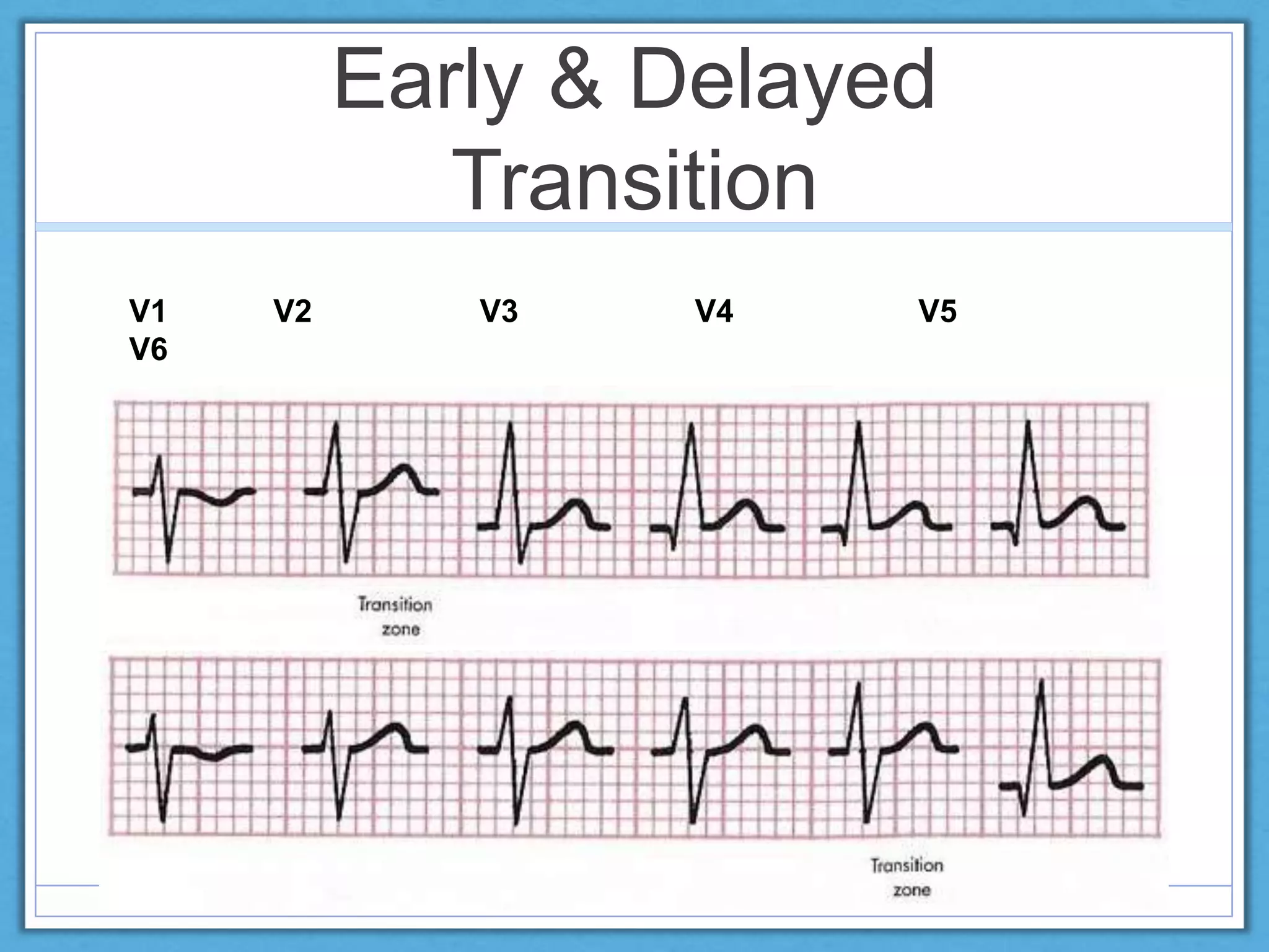 Normal ecg interpretation | PPTX