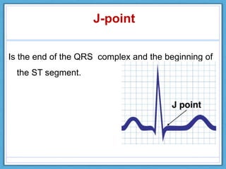 Normal ecg interpretation | PPTX