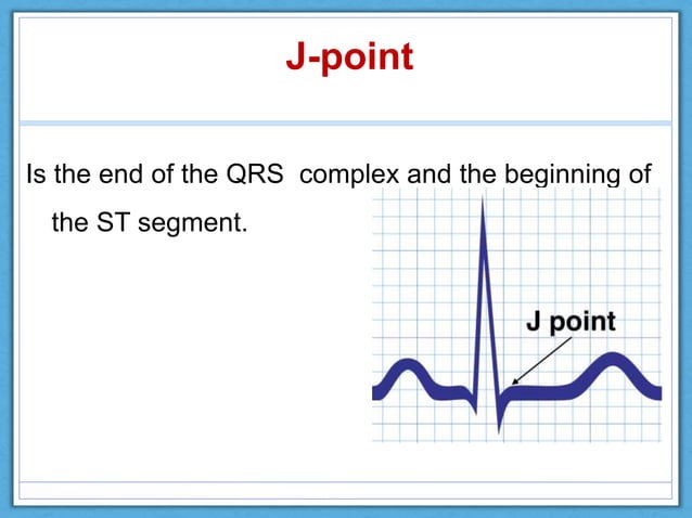 Normal ecg interpretation | PPTX | Heart and Cardiovascular Diseases ...