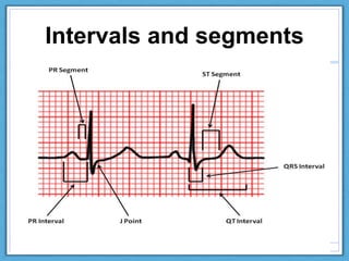 Normal ecg interpretation | PPTX