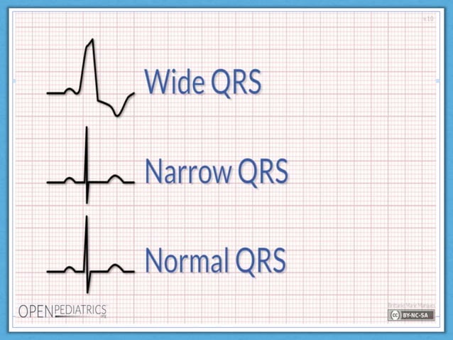 Normal ecg interpretation
