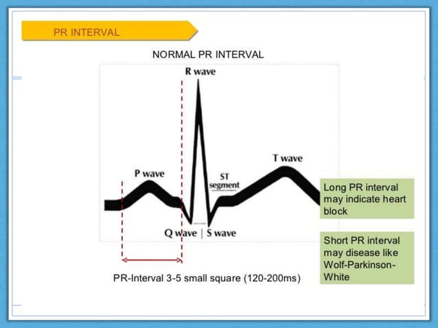 Normal ecg interpretation