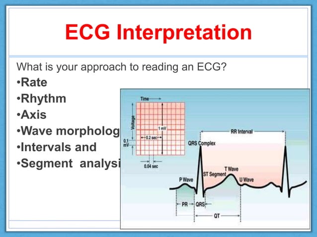 Normal ecg interpretation