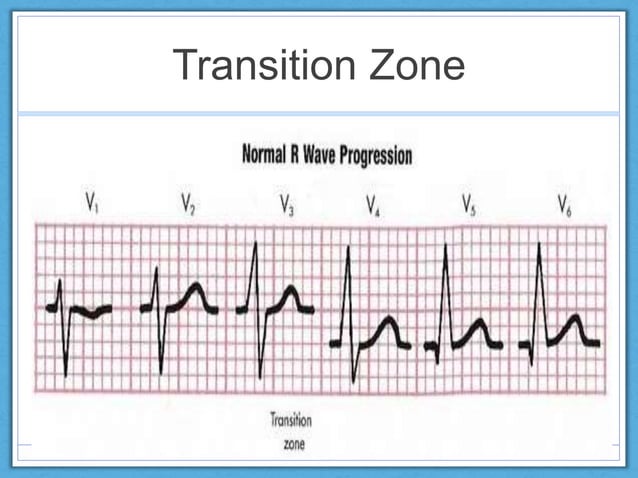 Normal ecg interpretation