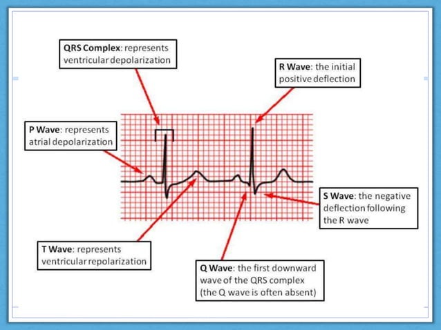 Normal ecg interpretation