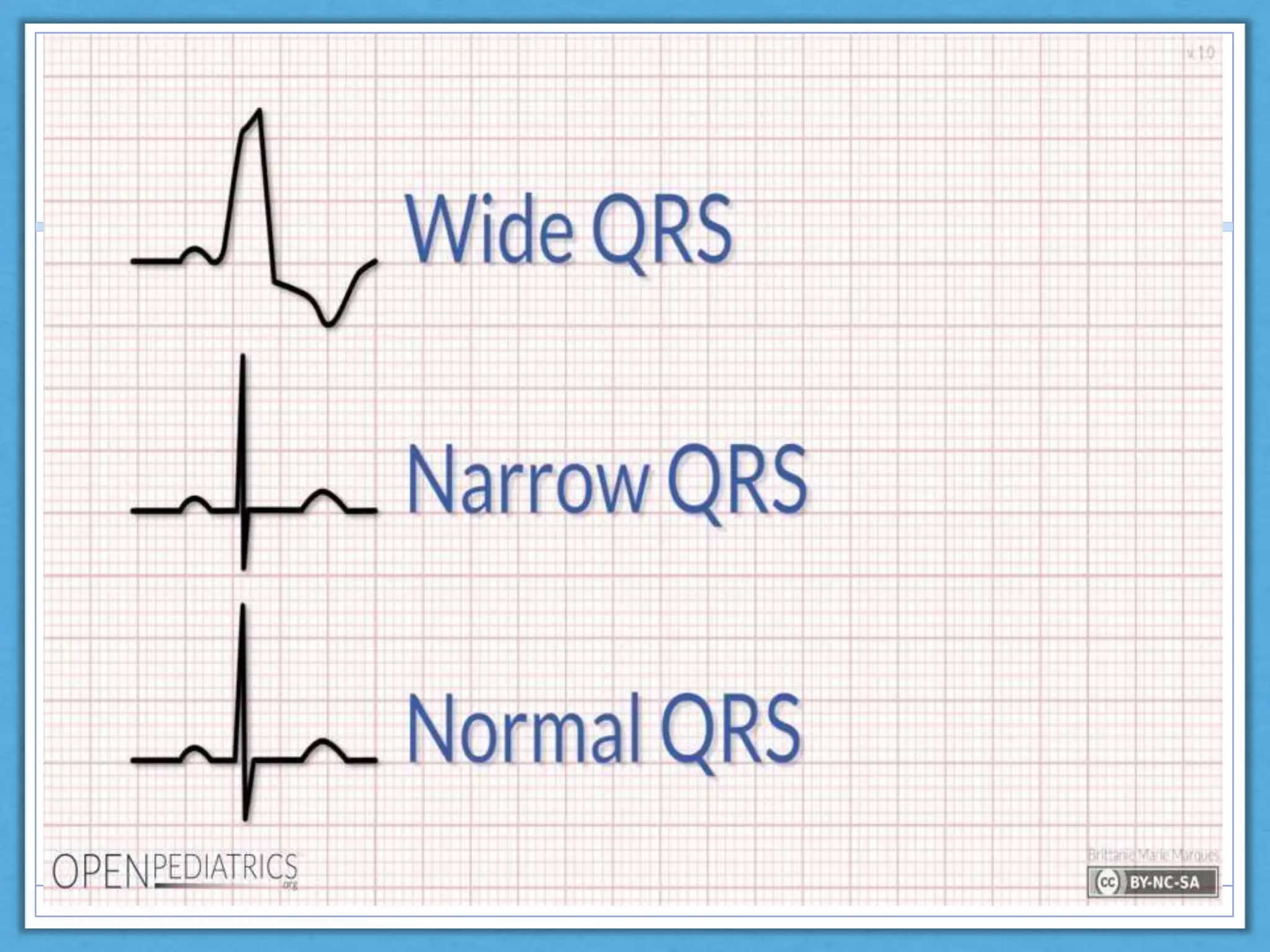 normalecginterpretation in human heart ppt | PPT