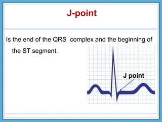 normalecginterpretation in human heart ppt | PPT