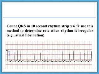 normalecginterpretation in human heart ppt | PPT