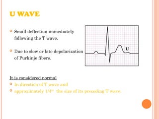 Normal Electrocardiogram Measurements.ppt