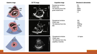 Normal Echocardiogram. Based on cardiac studies | PPT