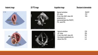 Normal Echocardiogram. Based on cardiac studies | PPT