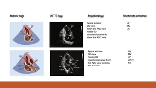 Normal Echocardiogram. Based on cardiac studies | PPT