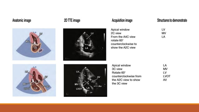 Normal Echocardiogram. Based on cardiac studies | PPT